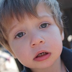 DiGeorge syndrome Archives - Patient Worthy