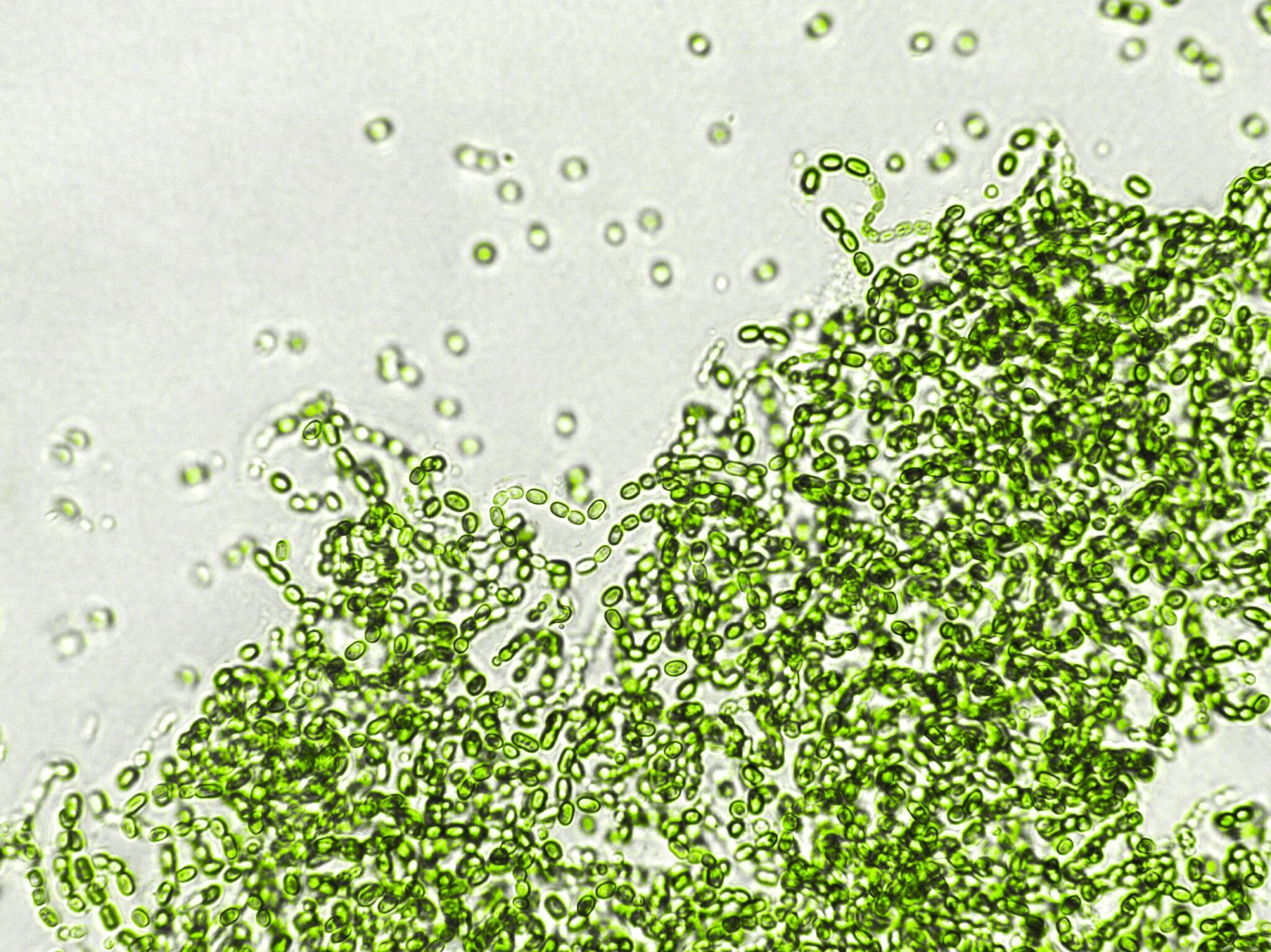 GSK’s combination meningococcal vaccine receives FDA approval – Patient ...
