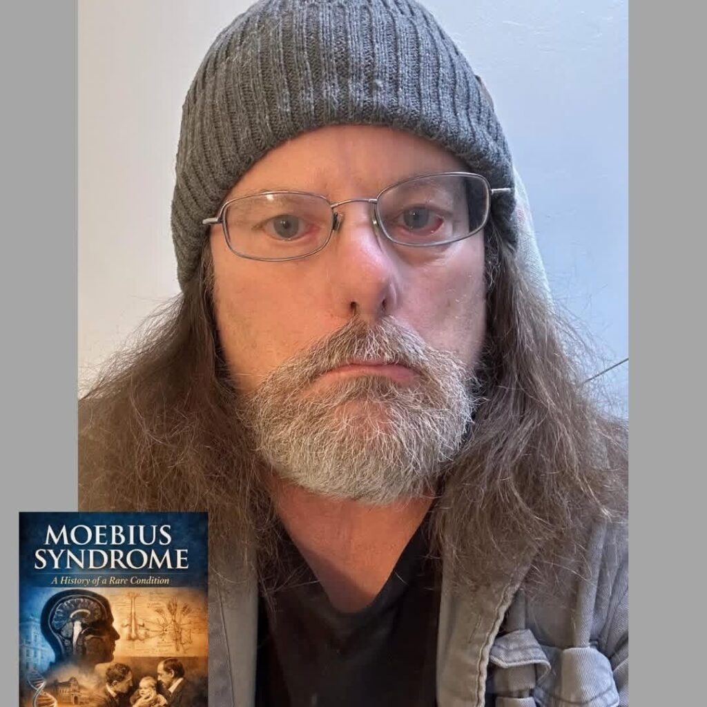 Awareness Isn’t the Hard Part — What 18 Years in the Moebius Syndrome ...