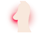 FDA Extends Review of AstraZeneca’s Investigational Breast Cancer ...