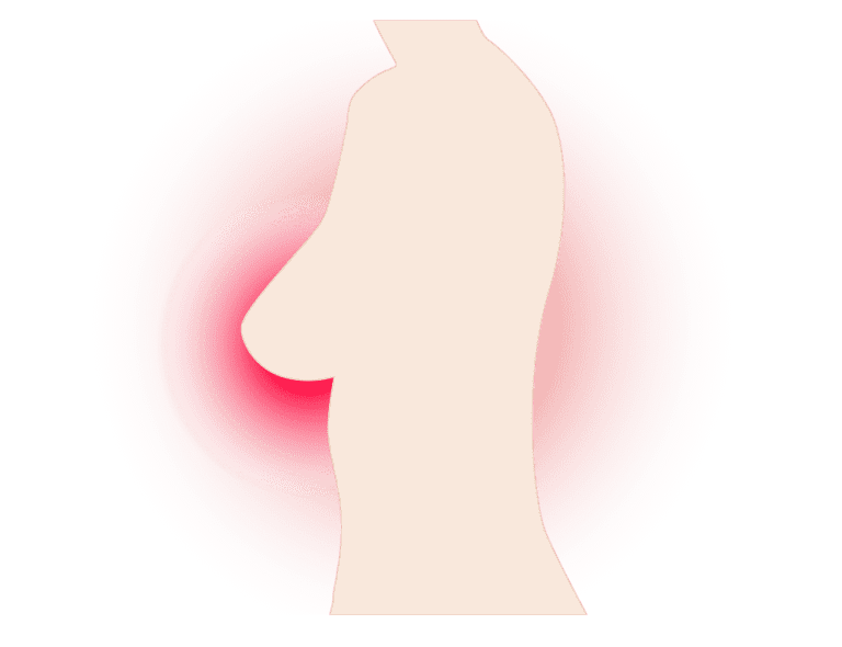 FDA Extends Review of AstraZeneca’s Investigational Breast Cancer ...
